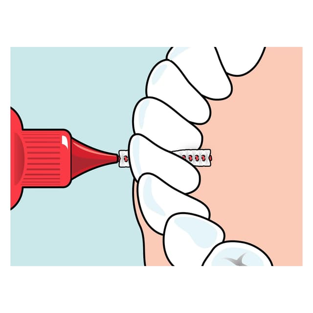 TePe® Interdentalbürste Original Rot - ISO 2: 0,5 mm | TePe